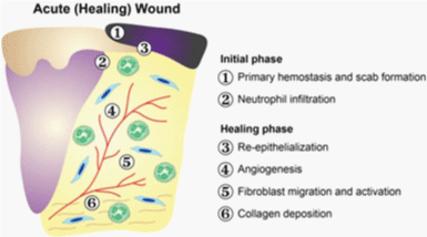 How Wound Healing Abnormalities Impact Clinical Care