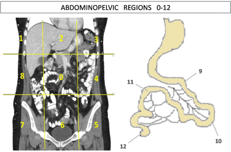 Peritoneal Cancer Indexes in Ovarian Carcinomatosis: Correlation ...