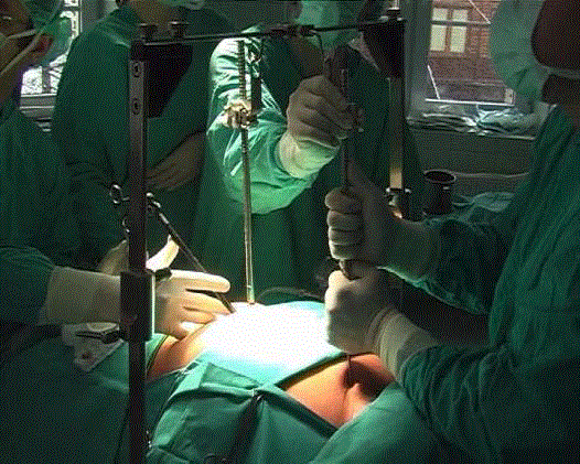 Transcervical Approach for Thoracic Operations