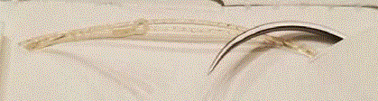 Unidirectional Barbed Sutures can be used Safely in Pediatric Gastro ...