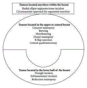 Breast Reconstruction after Lumpectomy
