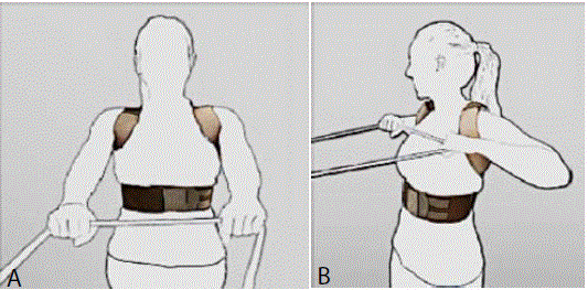 Splint Designed to be used in the “Pre- and Post-Operative” Correction ...