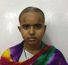 Single Stage Cranioplasty Following Calvarial Tumor Resection Using ...