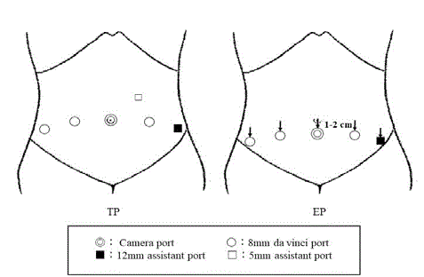 Clinical Outcomes Associated with Robot-Assisted Radical Prostatectomy ...